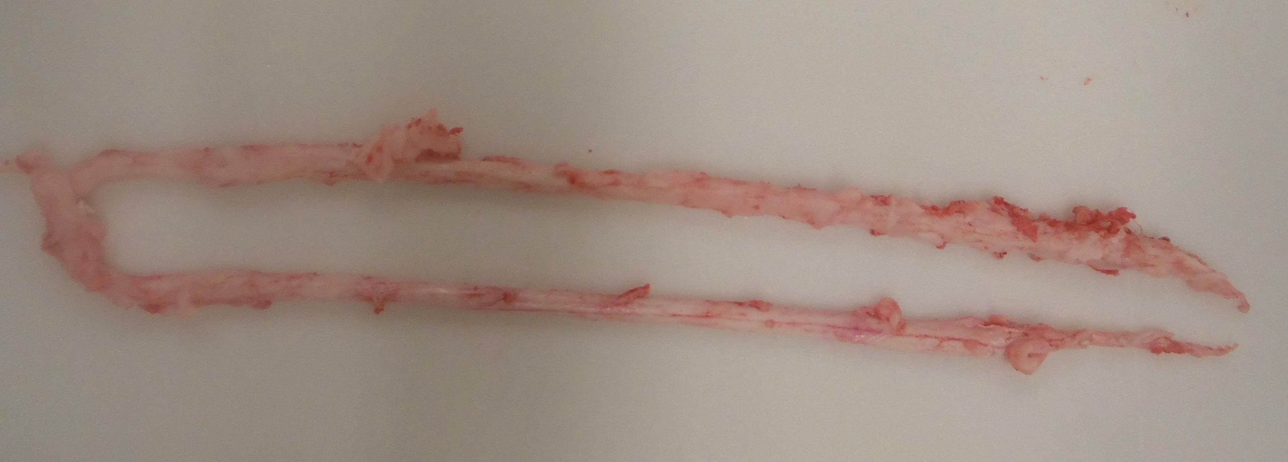 Nervous System - Tissue Source